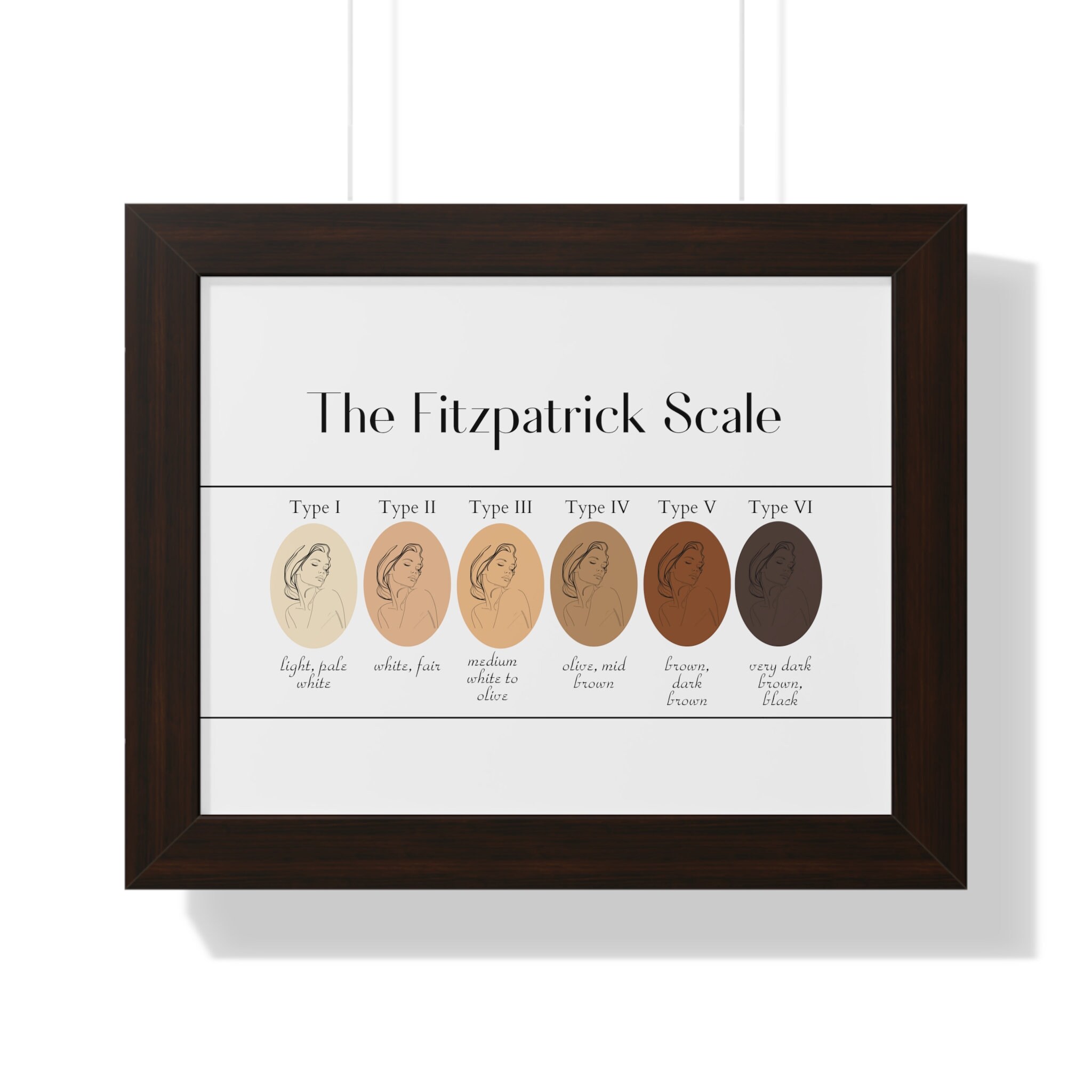 Fitzpatrick Scale, Dermatologist Art, Poster for Skin, Framed Art ...