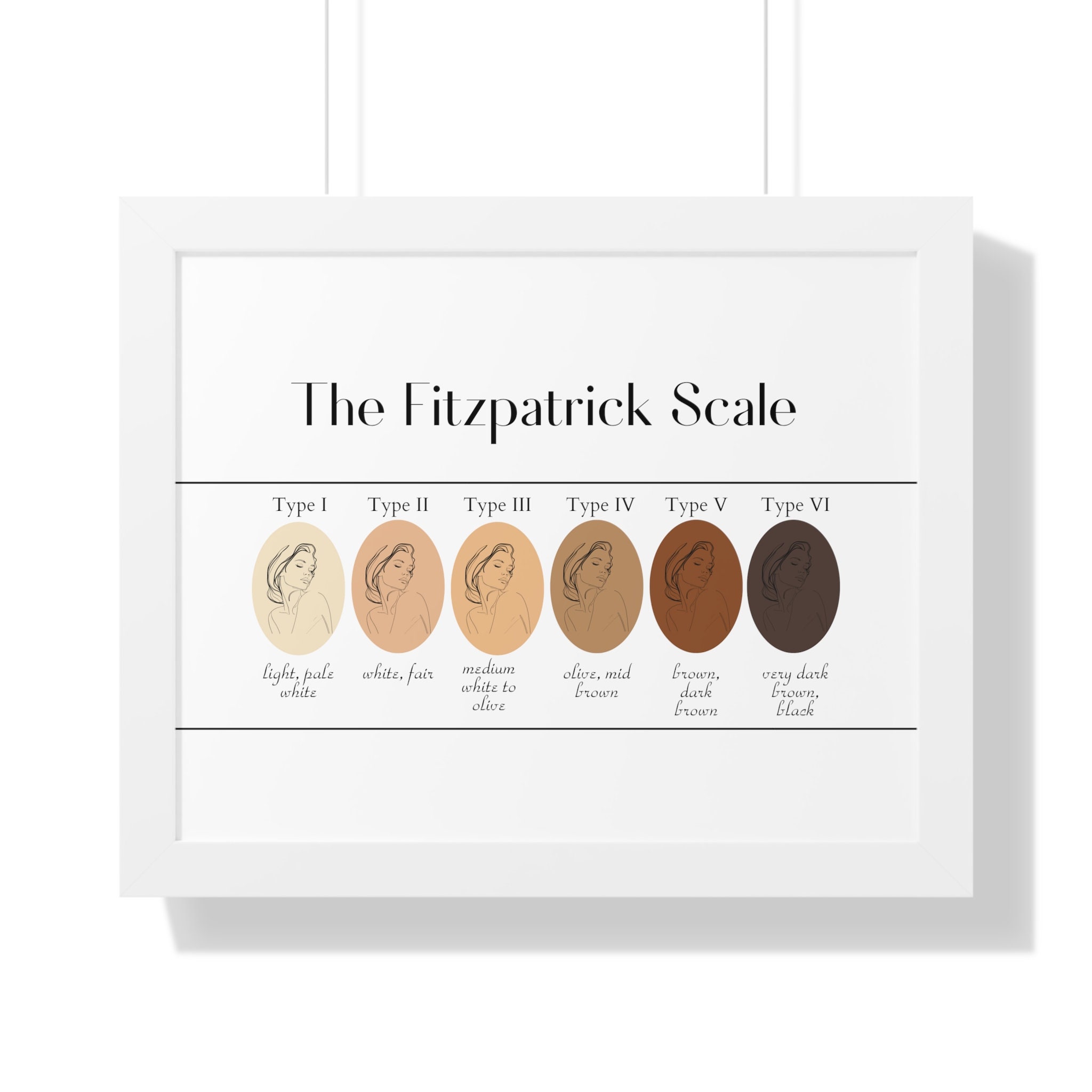 Fitzpatrick Scale, Dermatologist Art, Poster for Skin, Framed Art ...