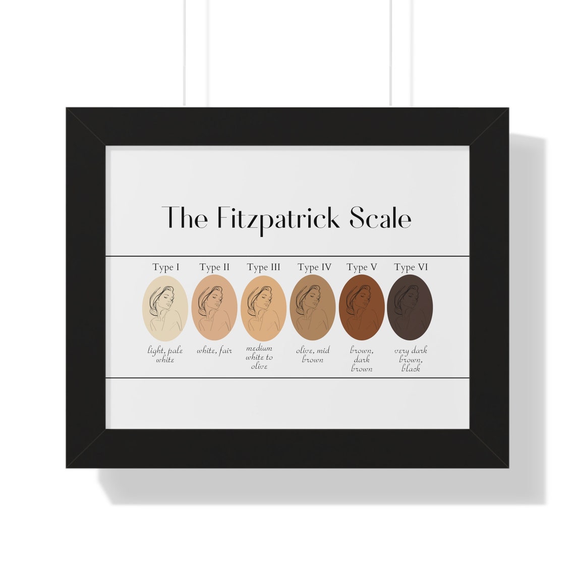 Fitzpatrick Scale, Dermatologist Art, Poster for Skin, Framed Art ...