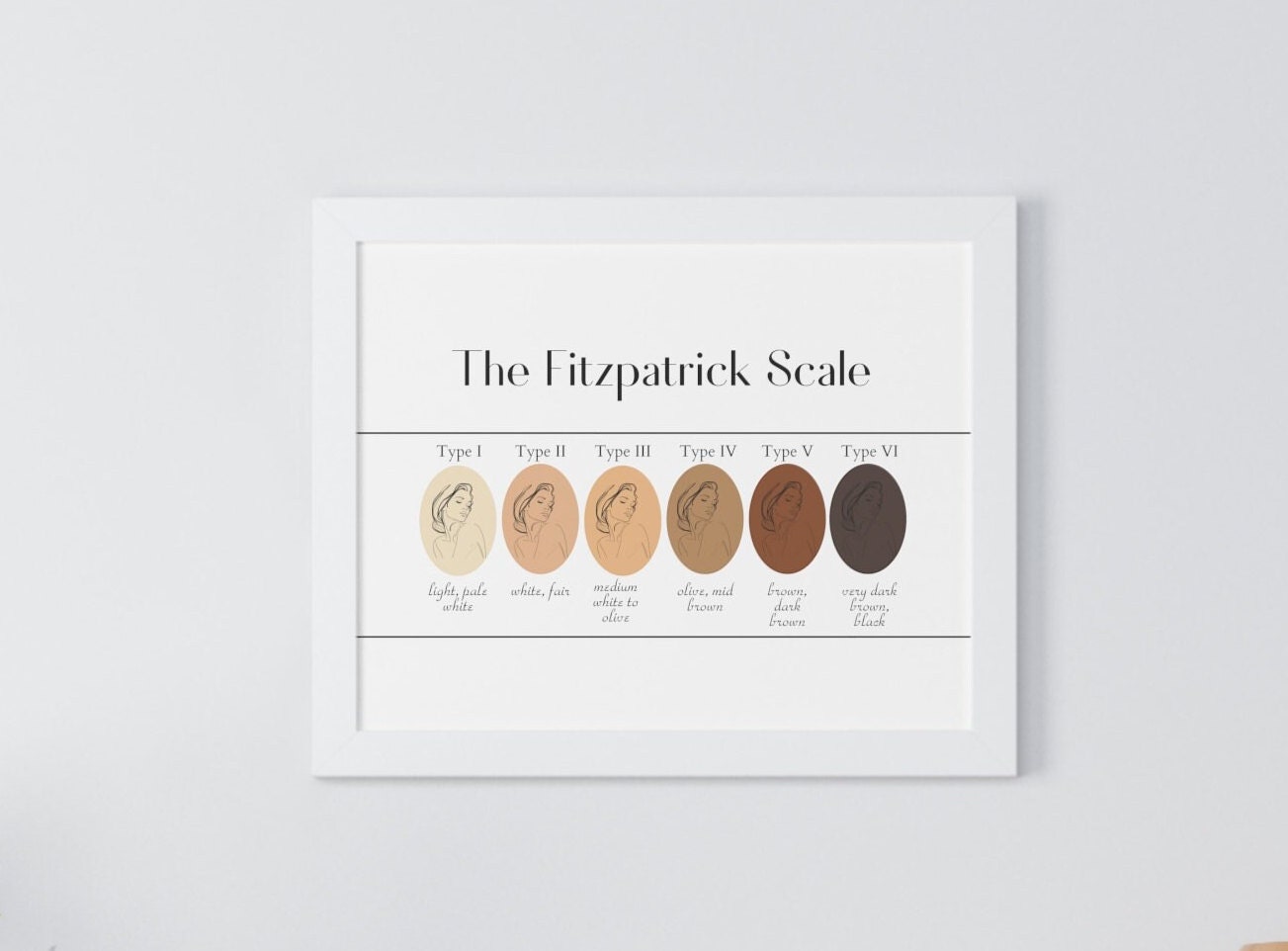 Fitzpatrick Scale, Dermatologist Art, Poster for Skin, Framed Art ...