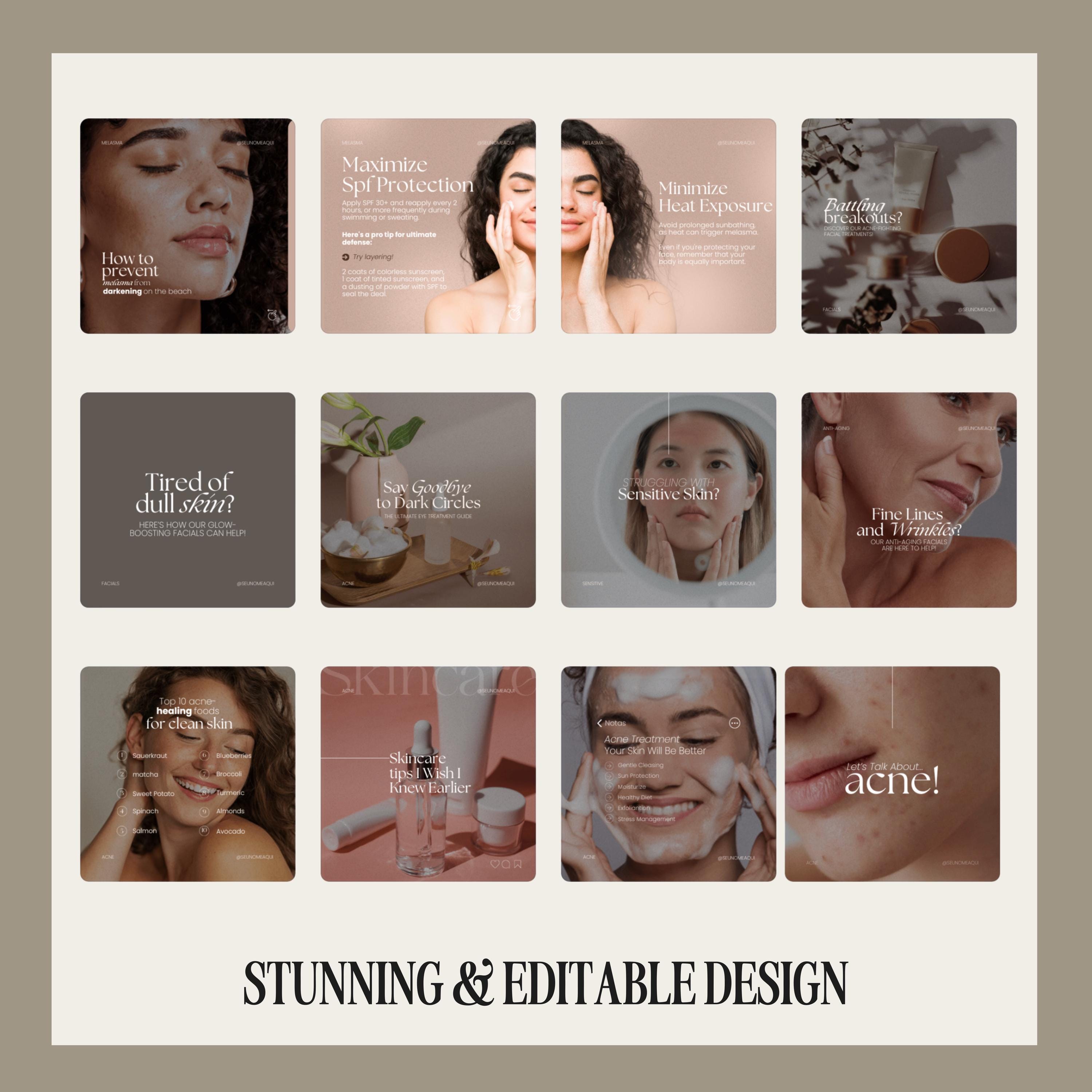 100 Esthetician Instagram Posts | Med Spa Marketing Canva Template ...