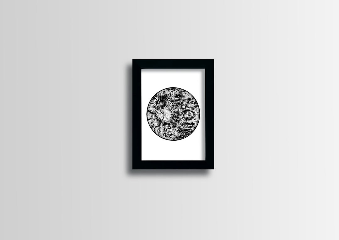 Ophthalmic Drawing of the Retina - Etsy