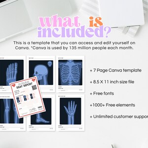Printable X-rays for Kids, Pretend Play Doctor, Pretend Play Nurse ...