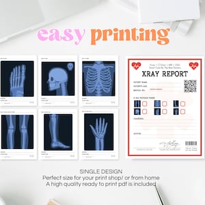 Printable X-rays for Kids: Pretend Play Doctor (PDF) - Etsy