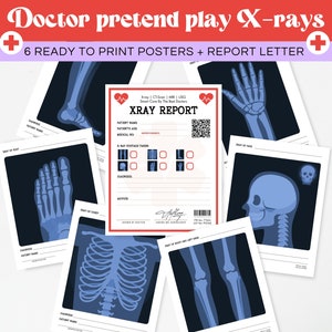 Printable X-rays for Kids, Pretend Play Doctor, Pretend Play Nurse ...