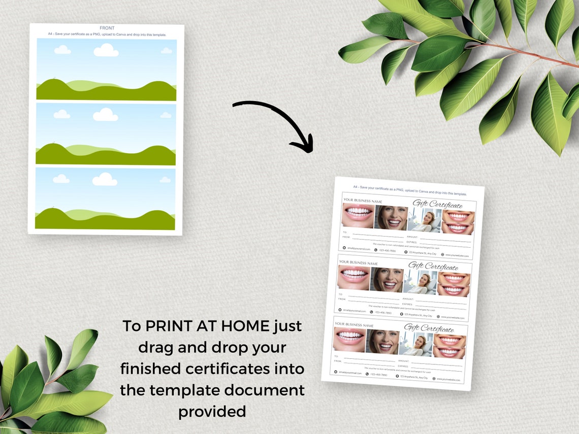 Teeth Whitening Gift Certificate Template: Editable Canva Design ...
