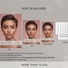 Botox Dermal Filler Packages Flyer Template, Spa Brand Advertisement ...