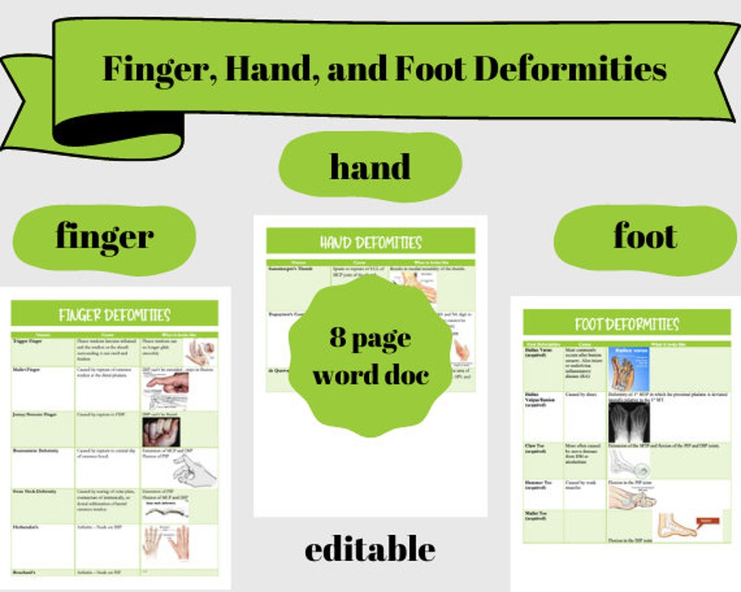 Finger, Hand, and Foot Deformities for NPTE Studying - Study Guide for ...