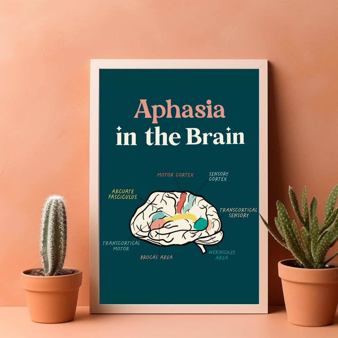 Printable Aphasia Language Poster Brain Anatomy for SLP - Etsy
