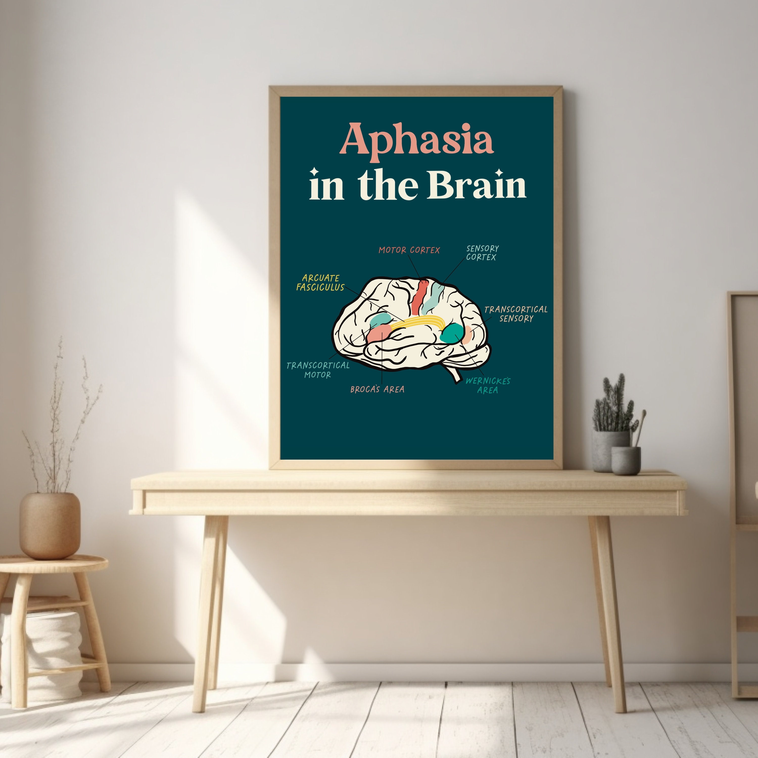 Printable Aphasia Language Poster Brain Anatomy for SLP - Etsy