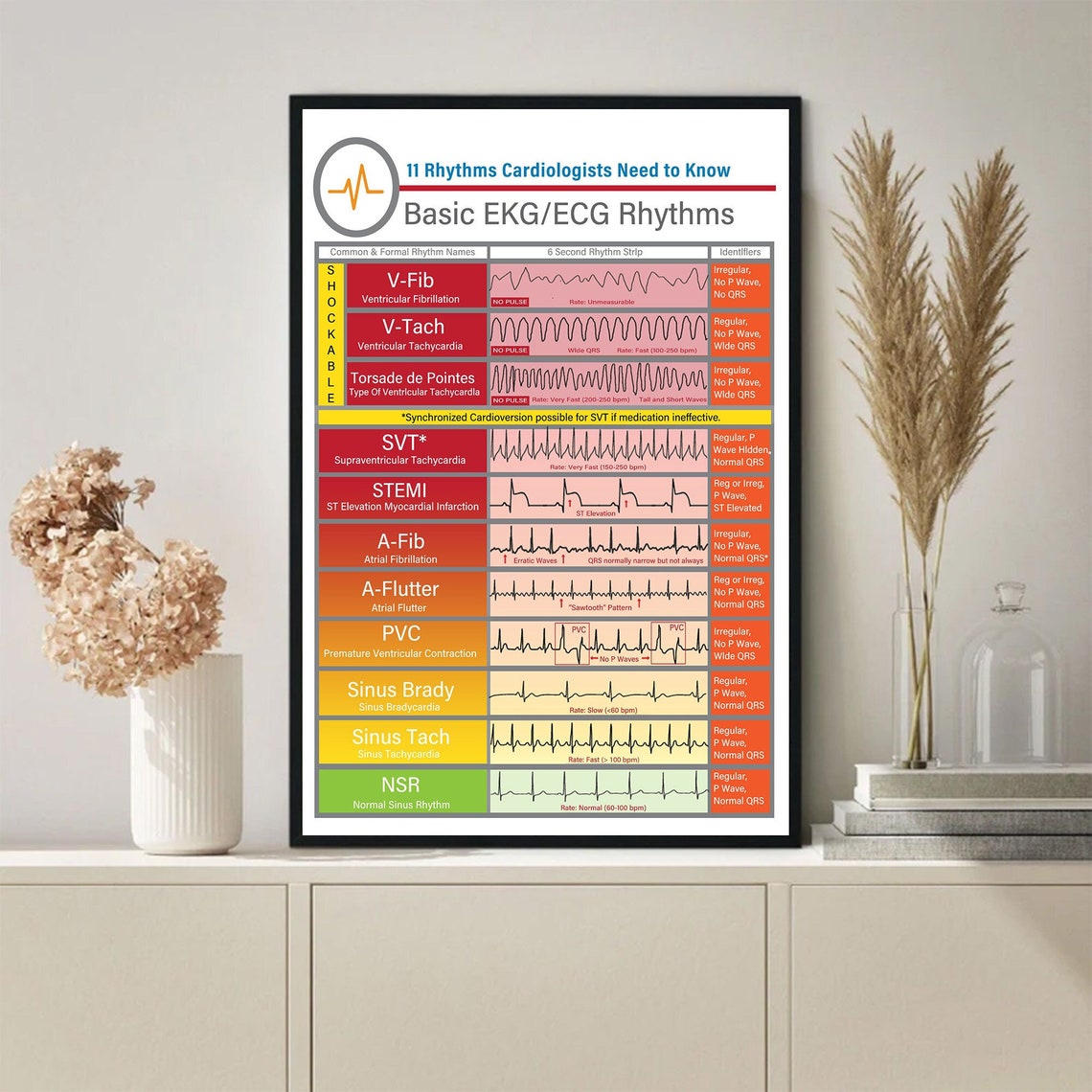 Basic EKG-ECG Rhythms Canvas Poster EKG Study Guide Poster | Etsy