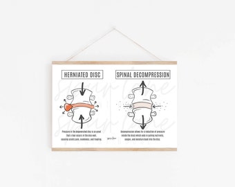 Spinal Decompression Poster - Etsy