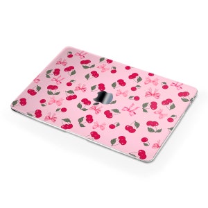 Cherries MacBook Case Cute Bows Kawaii MacBook Air 13 Air 15 M2 M3 Pro ...