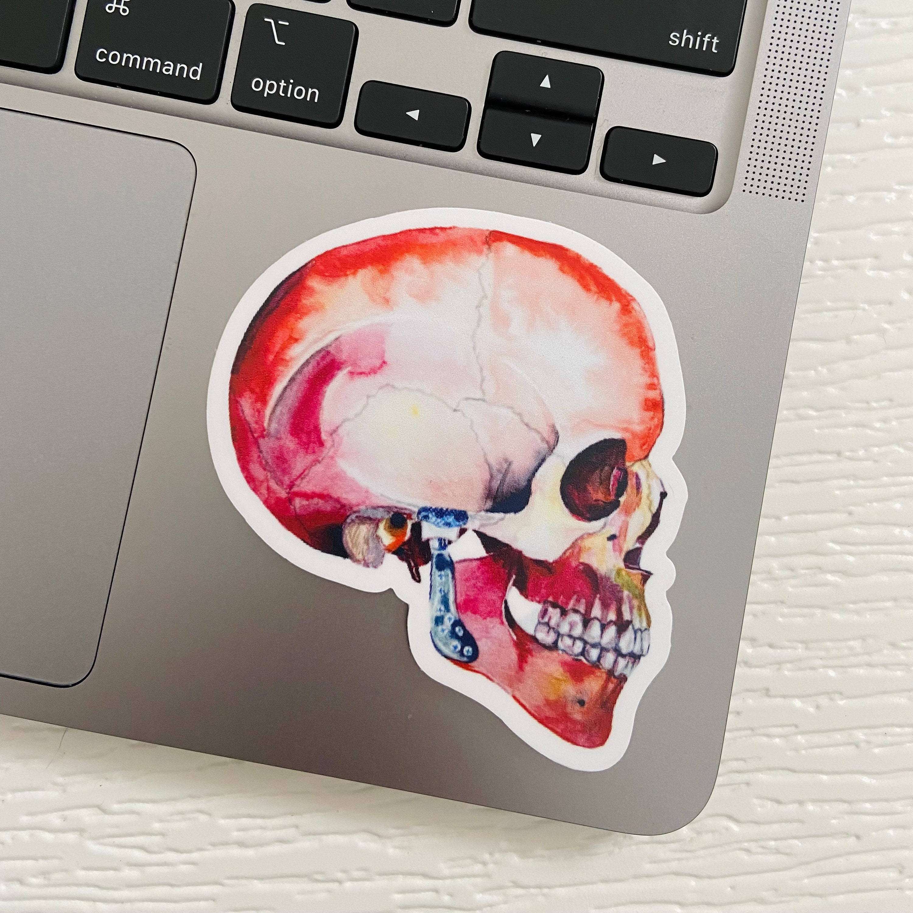 Oral Surgery Sticker Pack: Tmj-tjr/triple Jaw 2 Stickers - Etsy