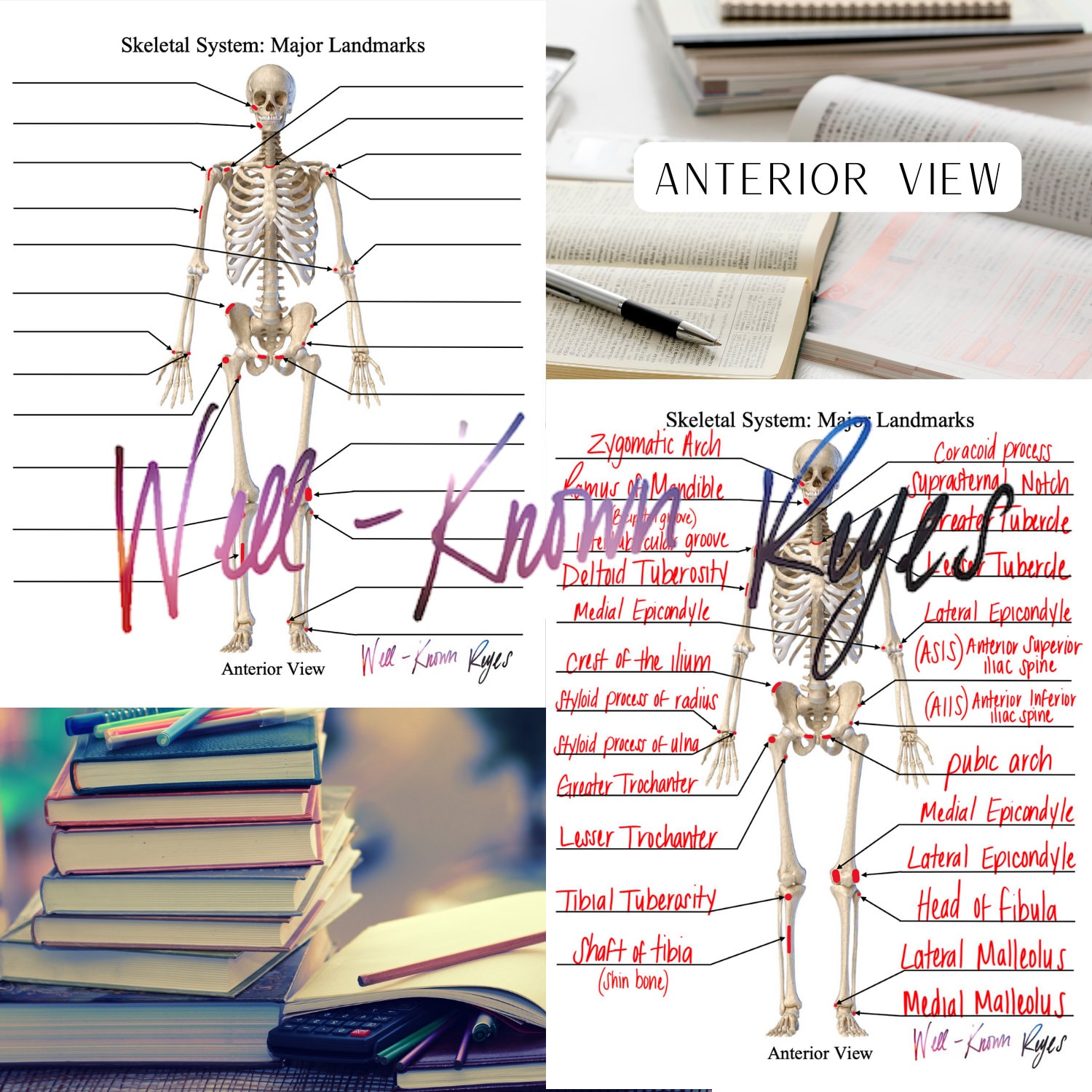 Skeletal System, Major Landmarks, Bony Landmarks, Anatomy & Physiology ...