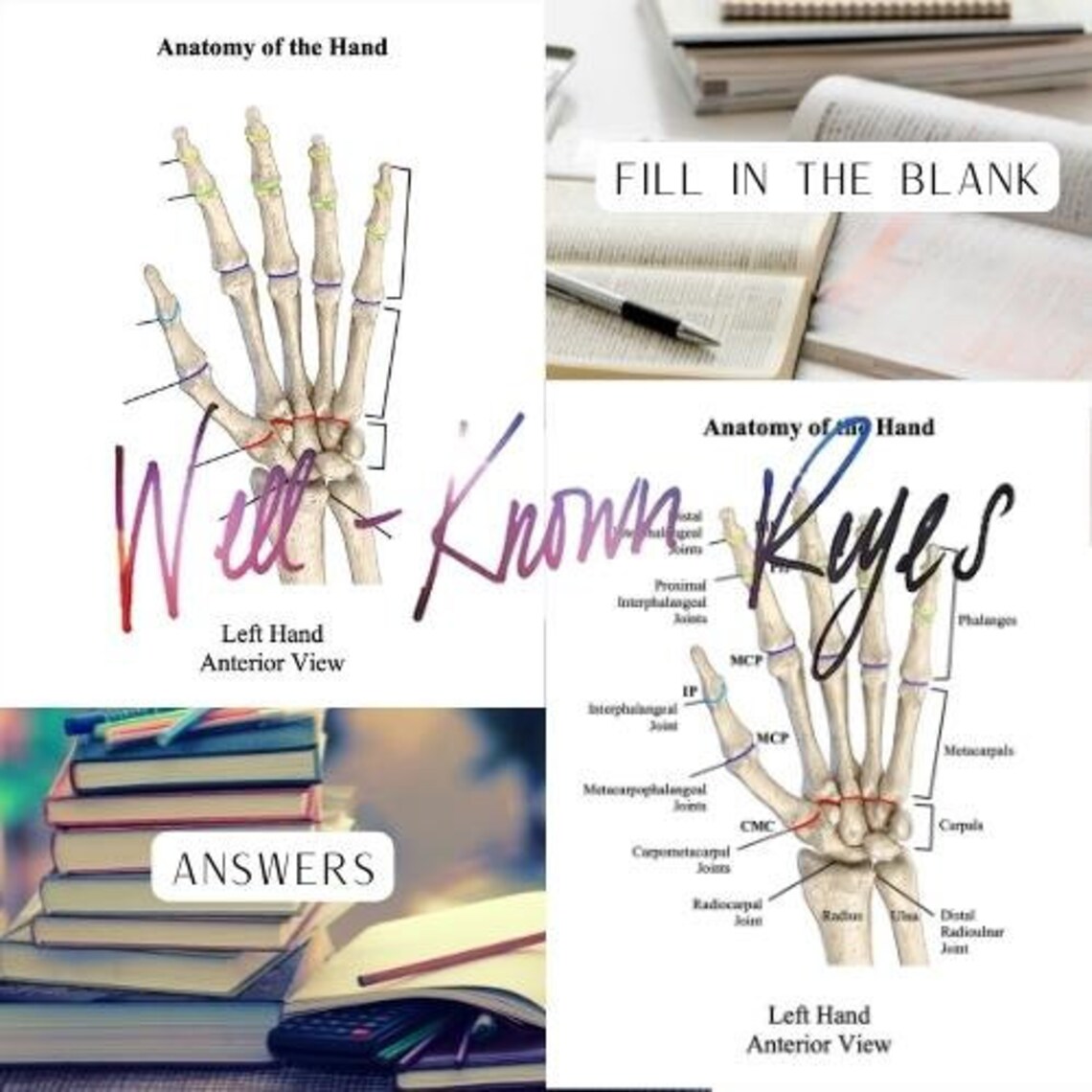 Anatomy of the Hand Worksheet, Study Guide, Bones, Joints, Anterior ...