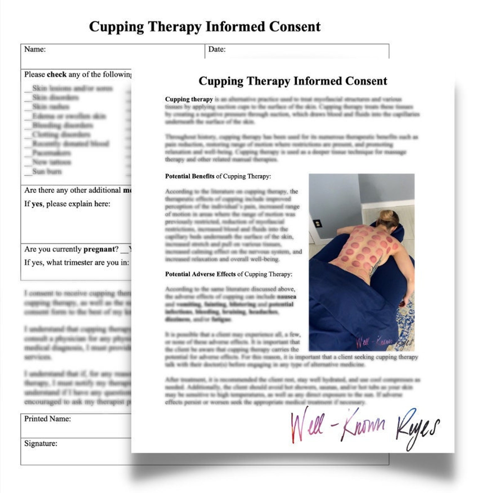 Cupping Therapy Informed Consent Form, Massage Therapy Cupping, Suction ...