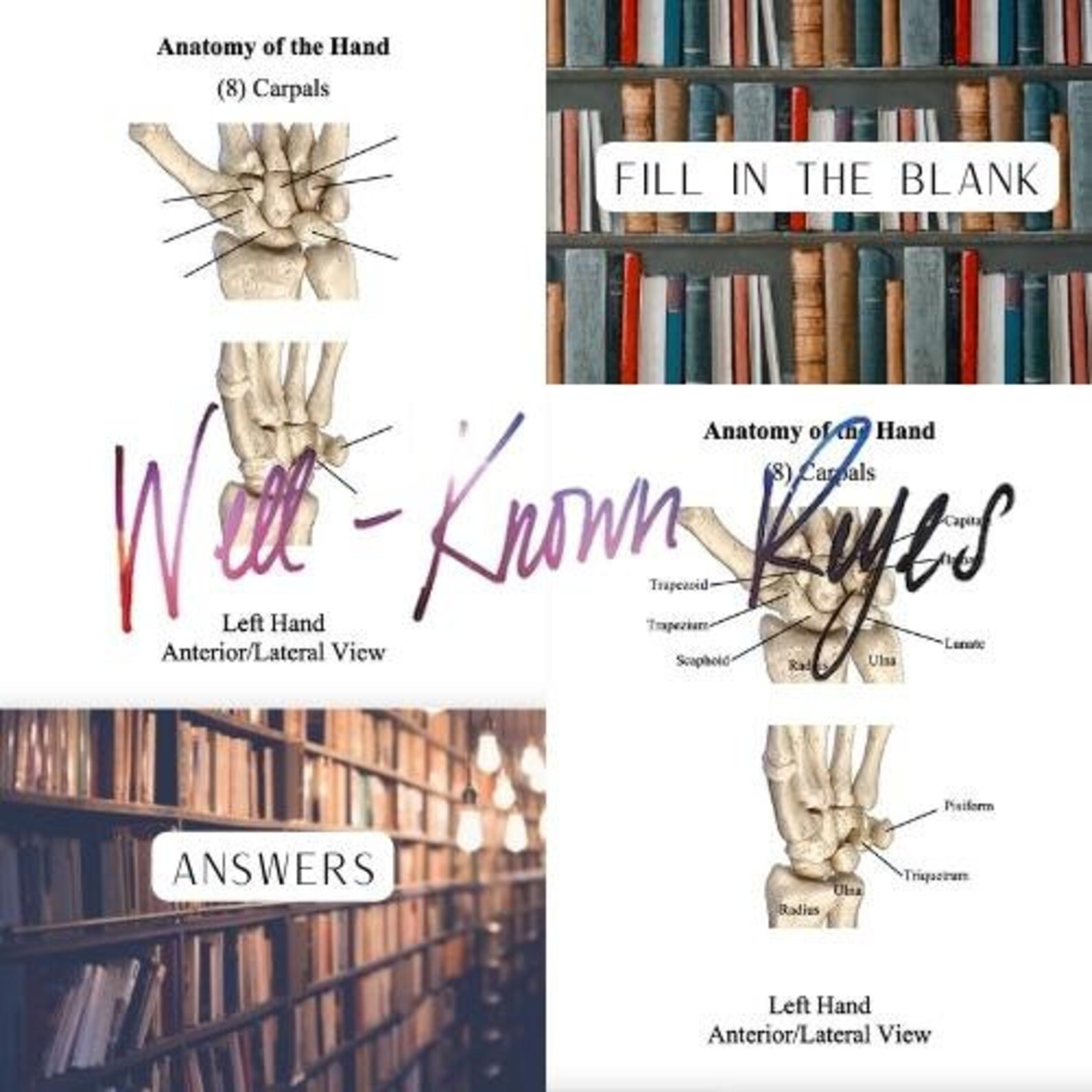 Anatomy of the Hand Worksheet, Study Guide, Bones, Joints, Anterior ...