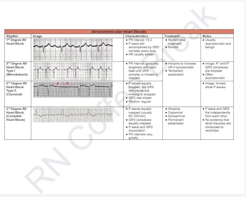 EKG Nursing NCLEX Study Notes - Etsy