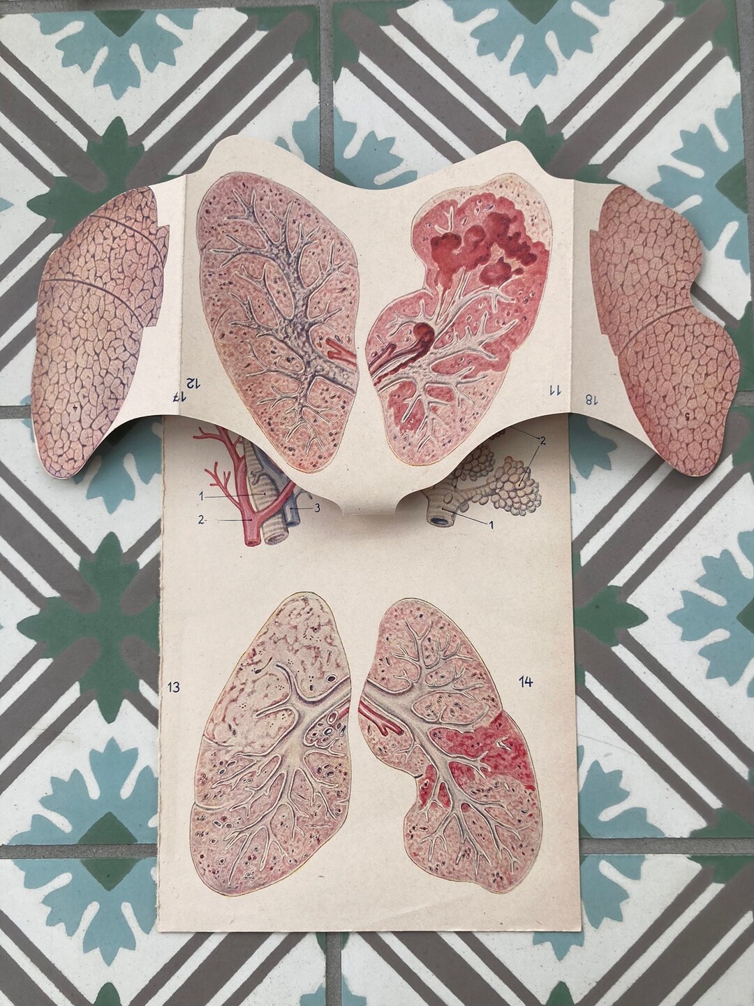 Foldout. Anatomical. Lung. Original. Antique. Vintage. Print. Color ...