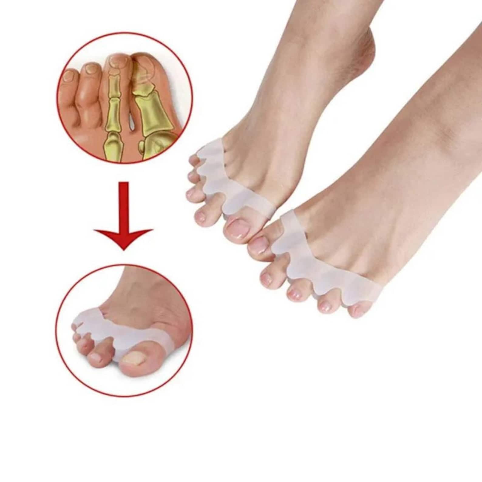 One Pair of Silicon Gel Toe Straightener | Toe Stretcher | Toe Spacer ...