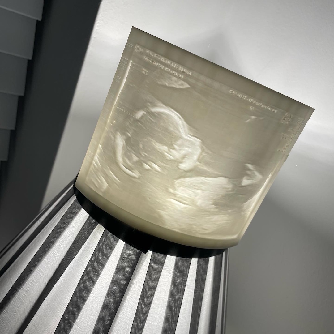 Baby Scan 3D Print - Lithophane Stand - Etsy