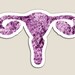Uterus Sticker, Uterus Art Gynecology Sticker, Gynecology Art ...