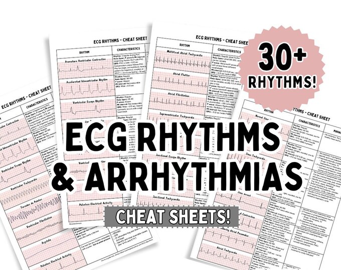 EKG Pocket Guide - Etsy