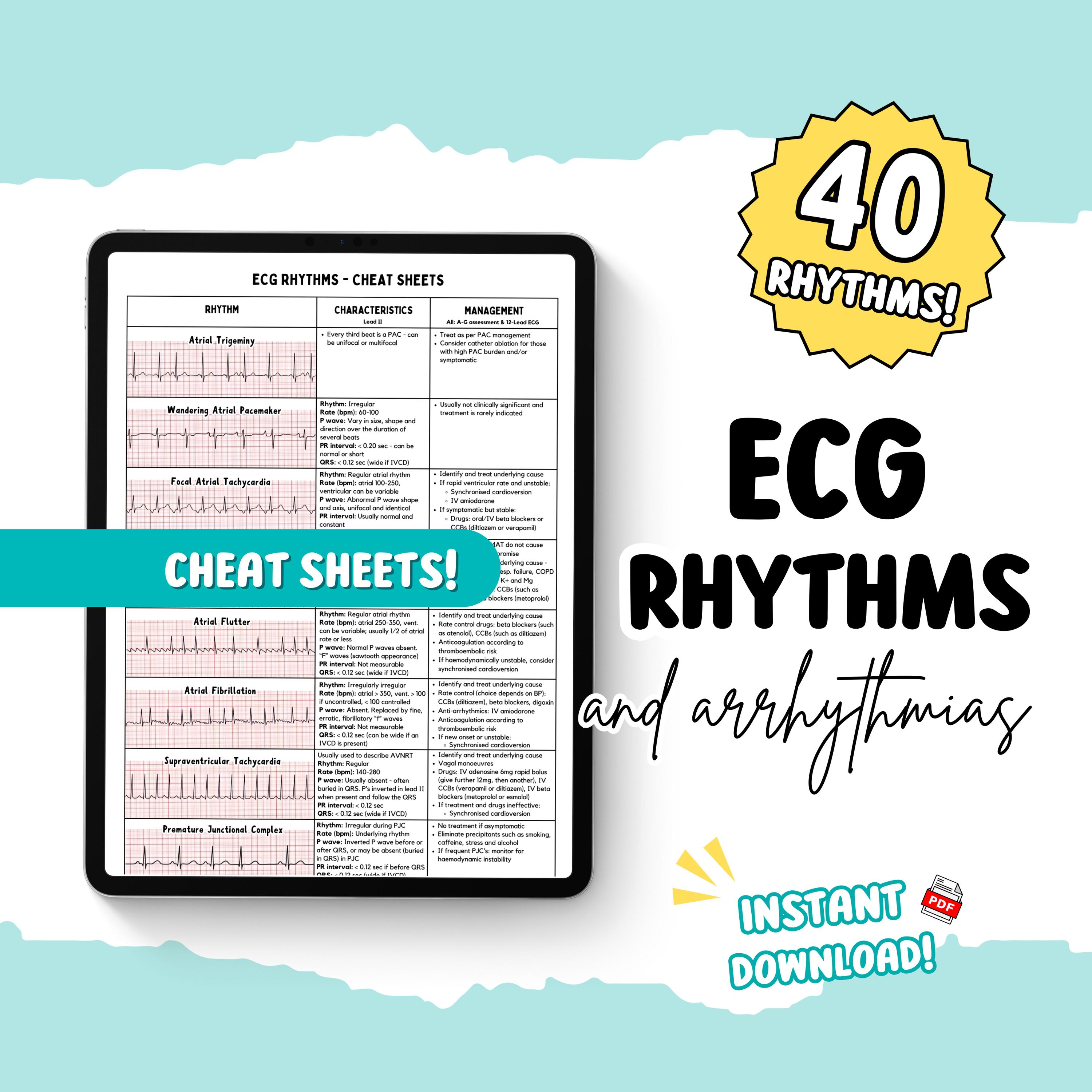 ECG Rhythm Cheat Sheets: 40 Cardiac Rhythms (digital Download) - Etsy
