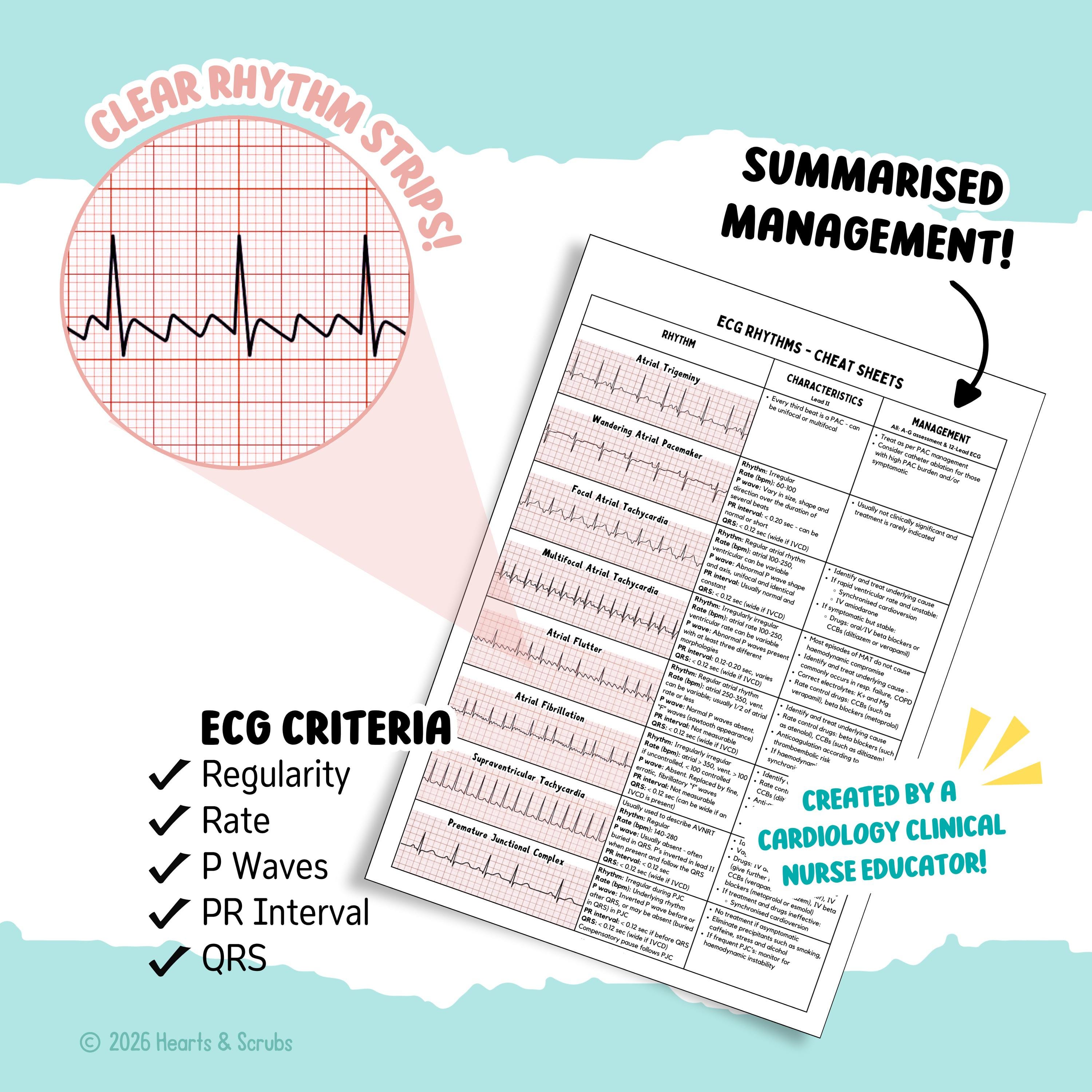 Advanced ECG Rhythms & Dysrhythmias Cheat Sheets | 55+ Rhythms | Nurse ...