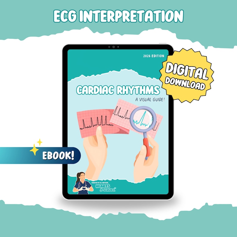 Cardiac Rhythms Visual Guide: EKG Interpretation - 75+ Page Ebook ...