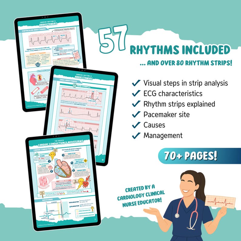 EKG Cardiac Rhythms Ebook | 75+ Page Visual Guide | Digital Download - Etsy