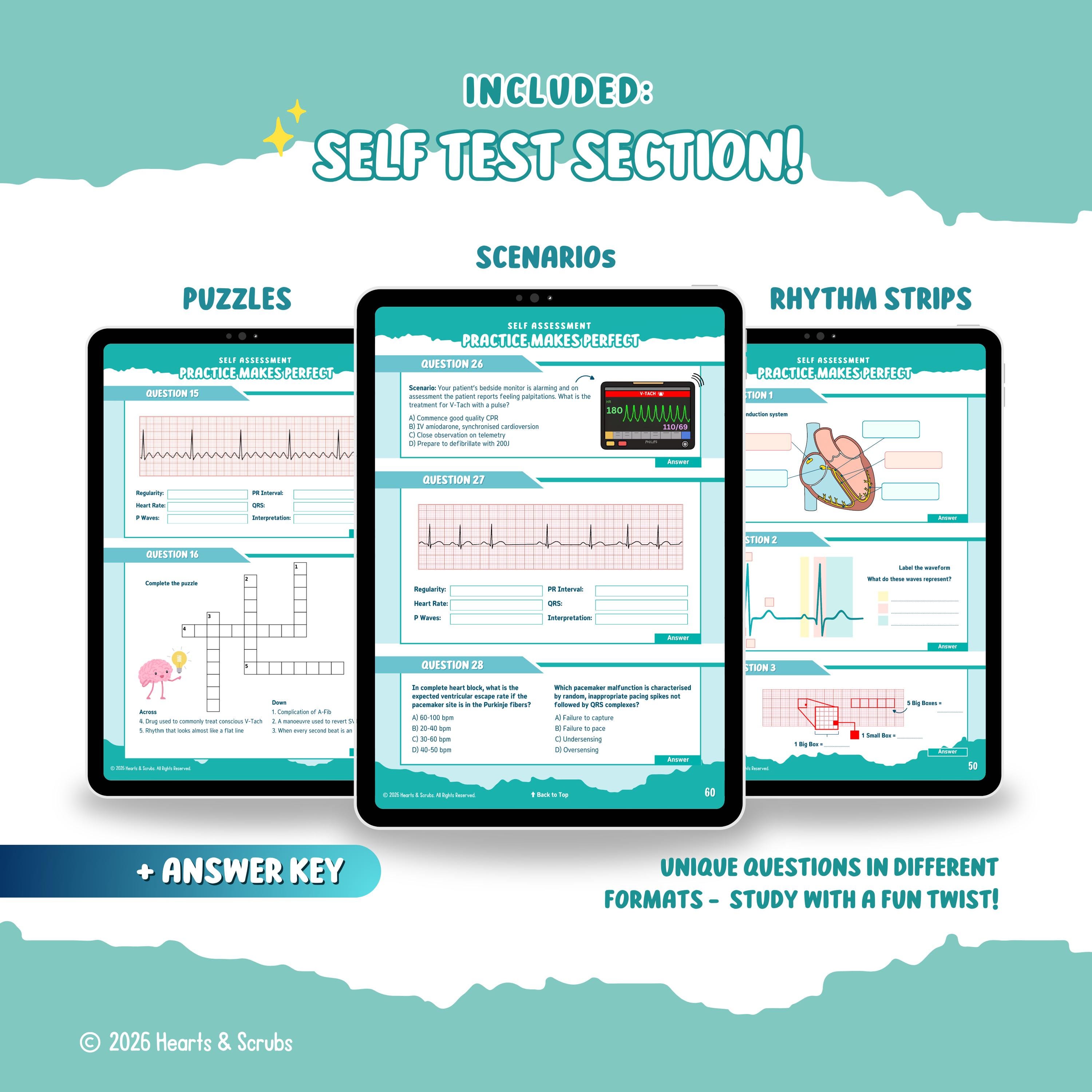 Cardiac Rhythms Visual Guide: EKG Interpretation - 75+ Page Ebook ...
