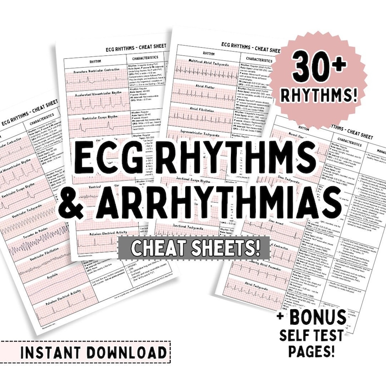ECG Rhythms & Dysrhythmias Cheat Sheets - Etsy Canada