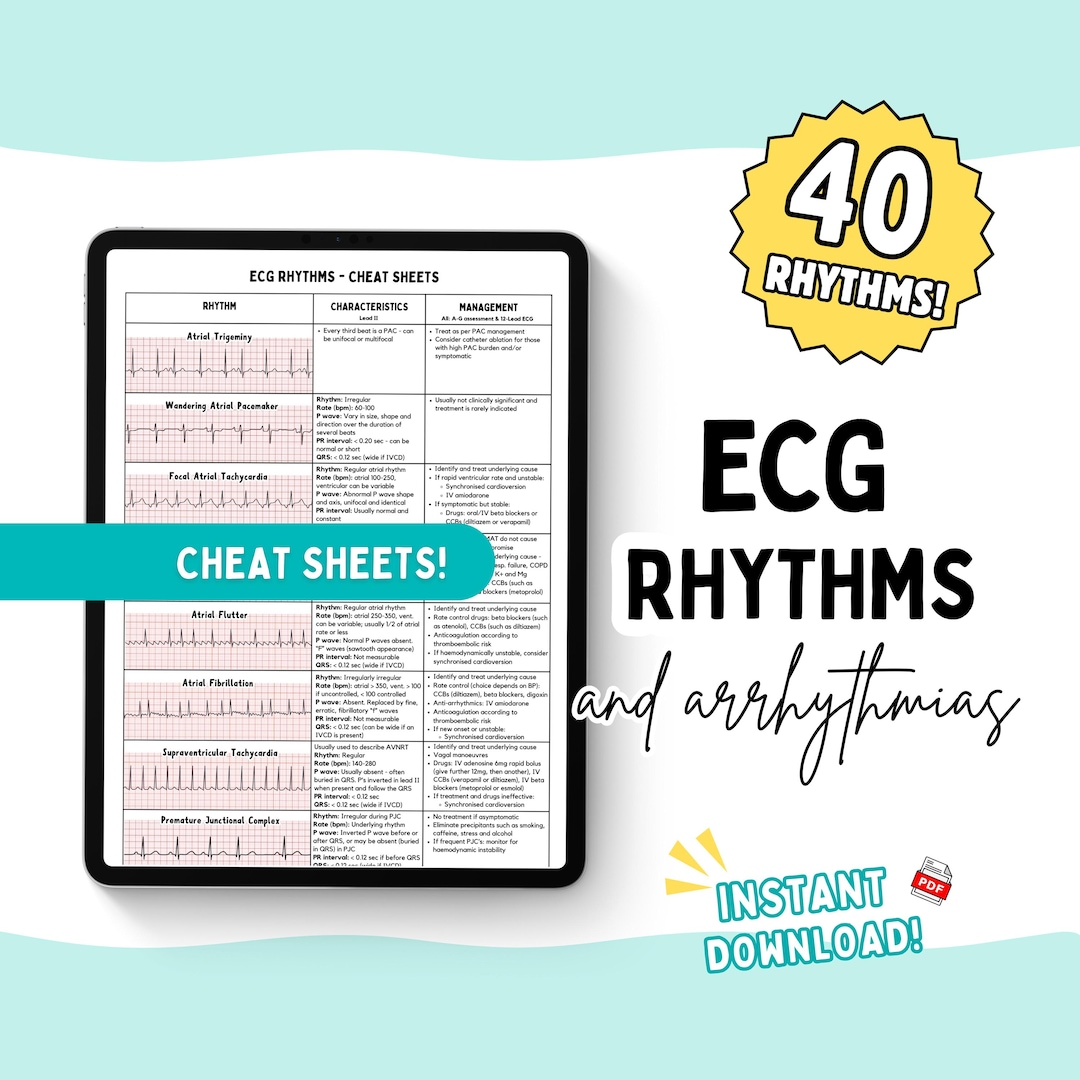 EKG & Dysrhythmias | Cheat Sheets | 40 Rhythms | Digital Download ...
