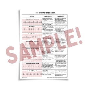 EKG & Dysrhythmias Cheat Sheets 30 Rhythms Digital Download Cardiac ICU ...