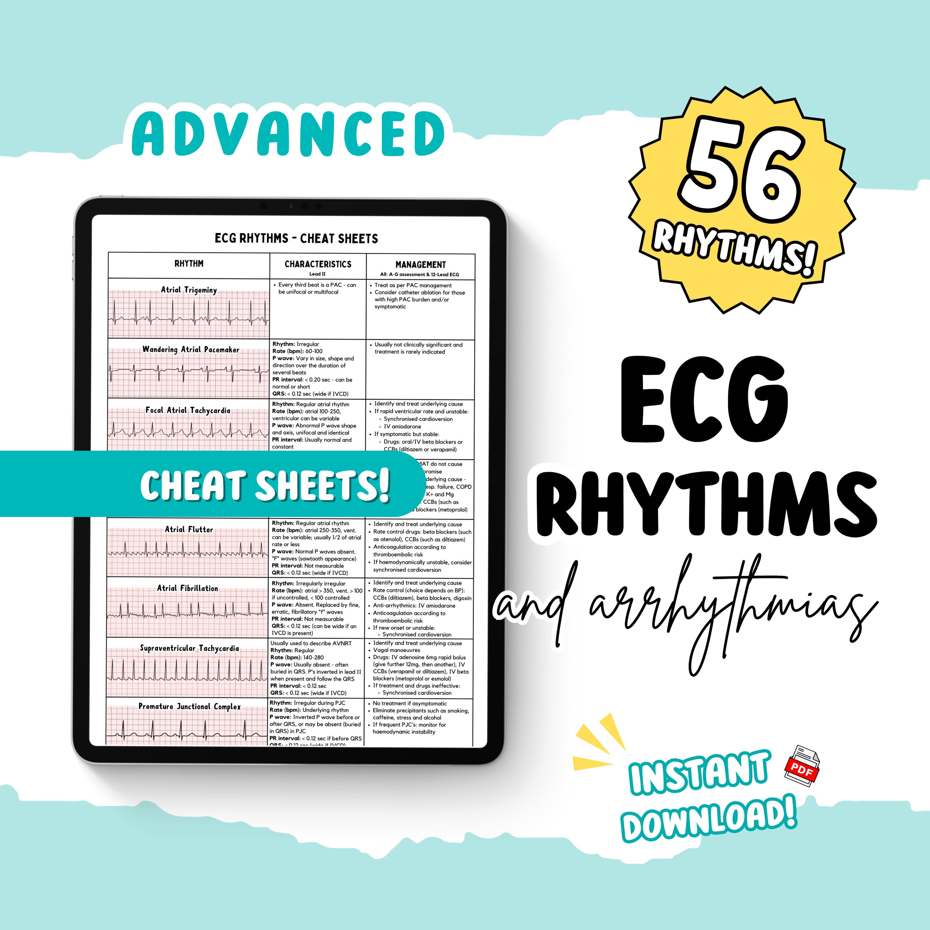 Advanced ECG Rhythms & Dysrhythmias Cheat Sheets | 55+ Rhythms | Nurse ...