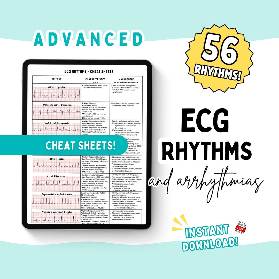 Advanced EKG & Dysrhythmias | Cheat Sheets | 55+ Rhythms | Digital ...