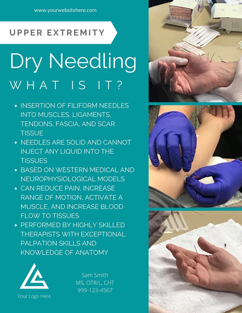 Dry Needling PDF - Etsy