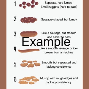 Bristol Stool Chart - Clinic Resource - Etsy