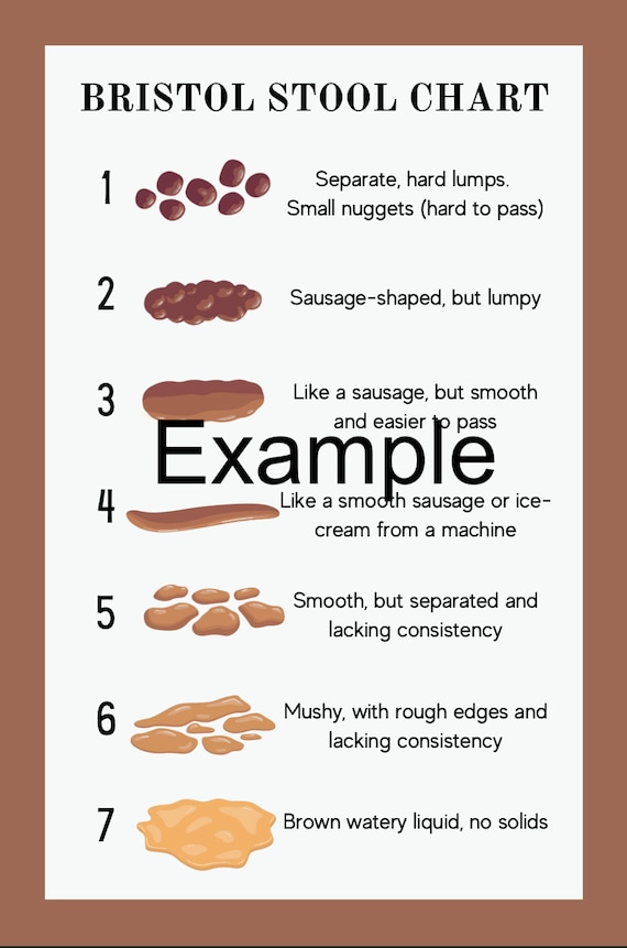 Bristol Stool Chart Infographic, Flat Vector Illustration, 50% OFF