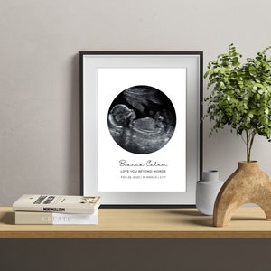 Ultrasound Artwork | Round Shape Ultrasound | Custom Birth Portrait ...