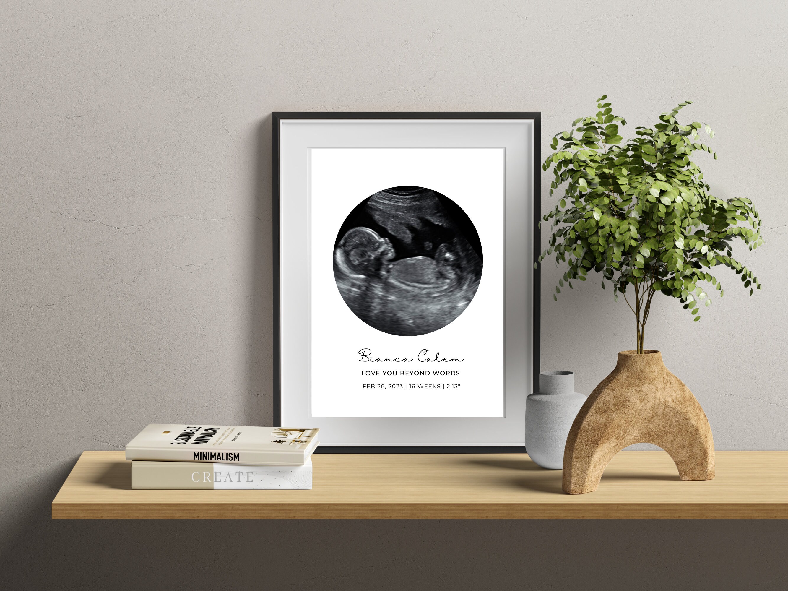 Ultrasound Artwork | Round Shape Ultrasound | Custom Birth Portrait ...