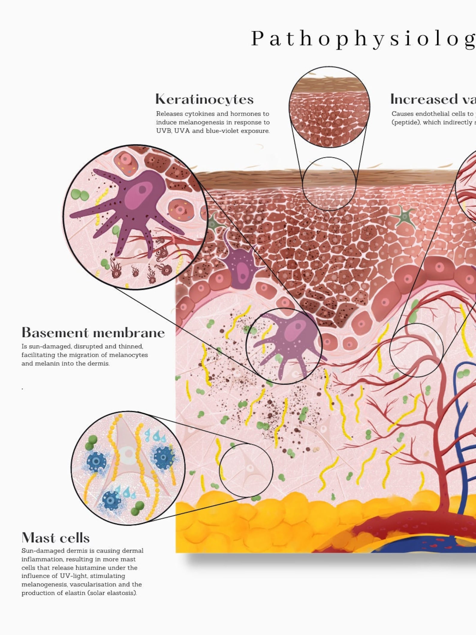 Melasma fisiopatología Anatomía de la piel Anatomía de la - Etsy México