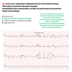 EKG Practice Test With Answers, EKG Practice Quiz, Quiz for Nursing ...