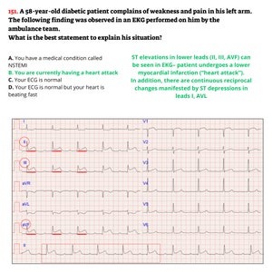 EKG Practice Test With Answers, EKG Practice Quiz, Quiz for Nursing ...