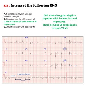 EKG Practice Test With Answers, EKG Practice Quiz, Quiz for Nursing ...