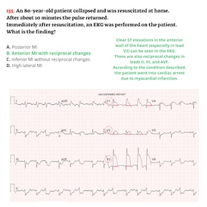 EKG Practice Test With Answers, EKG Practice Quiz, Quiz for Nursing ...