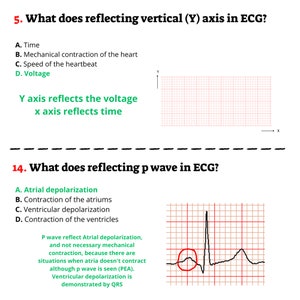EKG Practice Test With Answers, EKG Practice Quiz, Quiz for Nursing ...