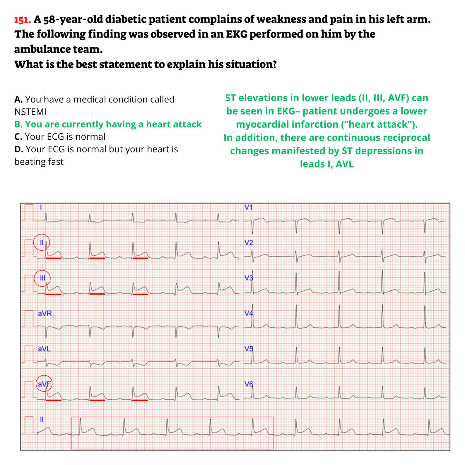 EKG Practice Test With Answers, EKG Practice Quiz, Quiz for Nursing ...